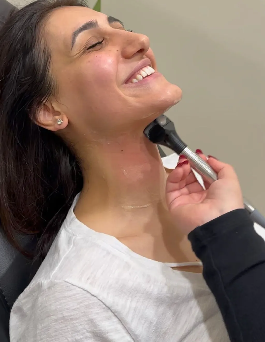 Forma Skin Tightening Burbank | The Skinn Suite Aesthetics