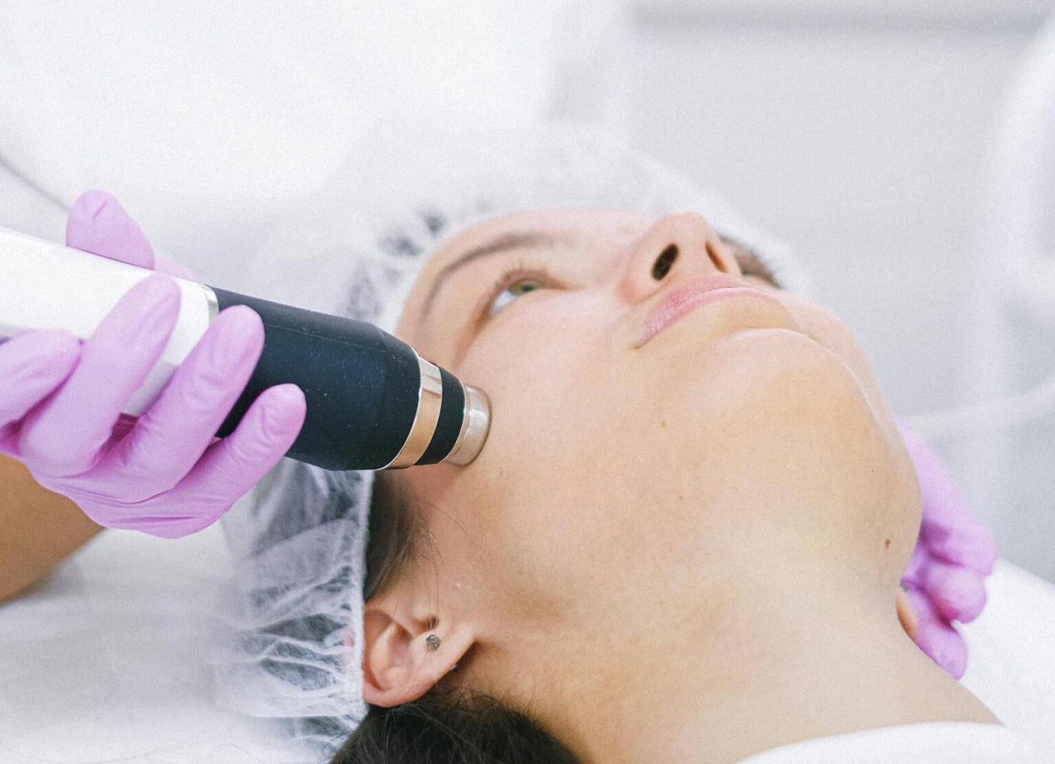 Forma Facial Burbank | Forma RF Skin Tightening